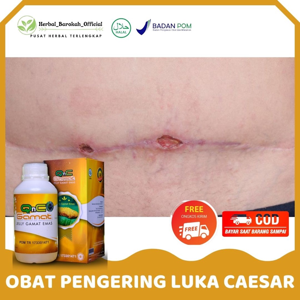 Jual Obat Oles Pereda Nyeri Luka Caesar , Luka Bengkak , Bernanah ...