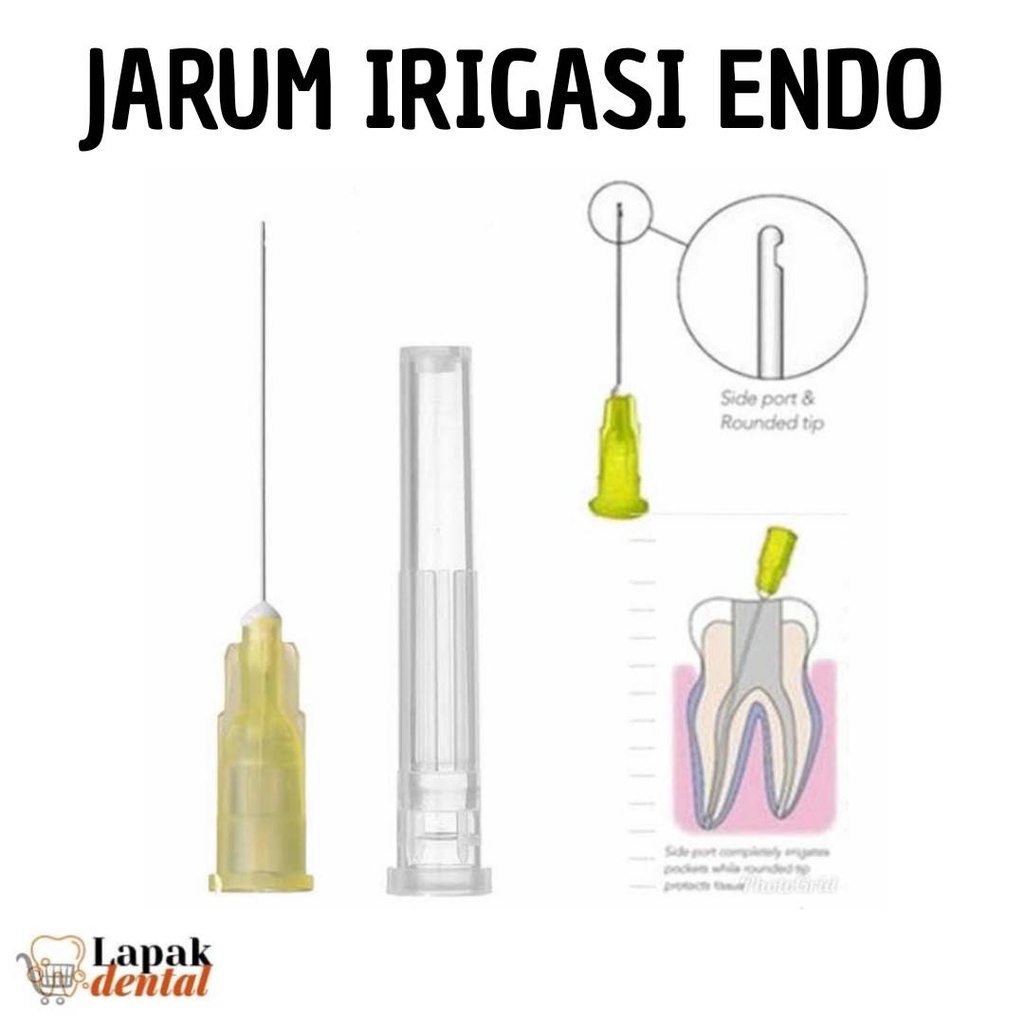Jual Dental jarum irigasi endo 30G kuning / endodontic irrigation ...