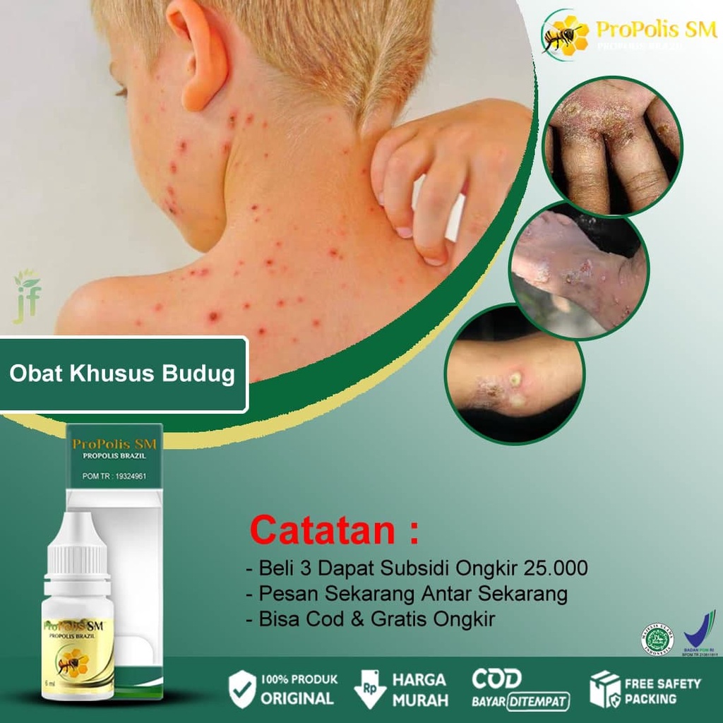 Jual Obat Budug, Eksim, Kurap, Herpes, Infeksi Kulit, Scabies, Jamuran ...