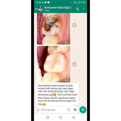 Jual TOTTH DECAY PENUMBUH GIGI BERLUBANG DAN OBAT SAKIT GIGI HERBAL ...