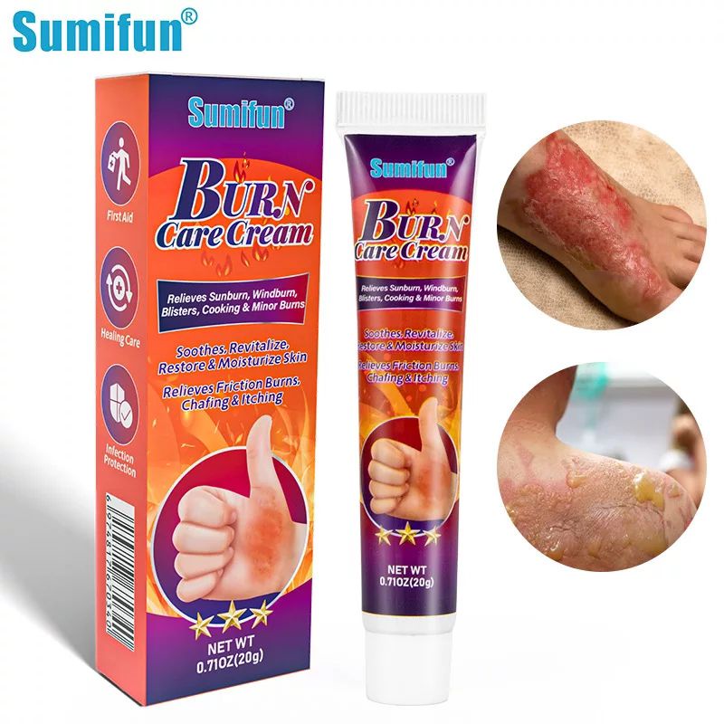 Jual burn care cream/salep luka bakar | Shopee Indonesia
