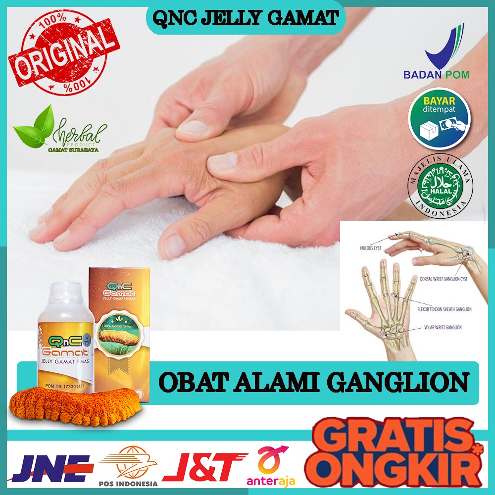 Jual Obat Ganglion, Benjolan di Tangan, Tumor & Kanker Sendi, Kista ...