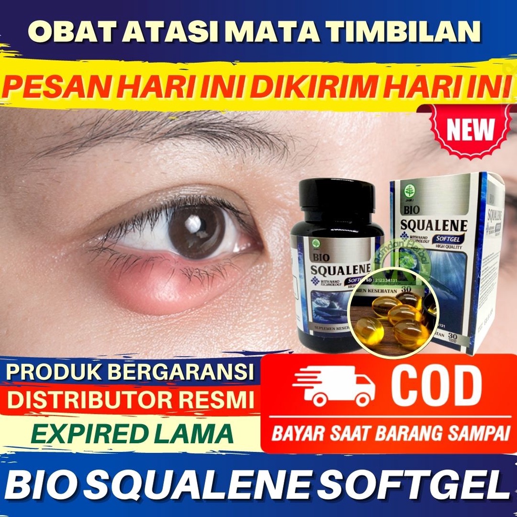 Jual Obat Atasi Mata Timbilan Mata Bintitan Benjolan di Kelopak Mata ...