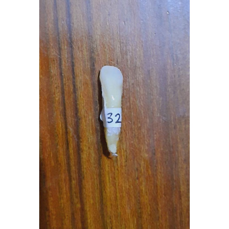 Jual Gigi insisivus lateral kiri bawah (gigi 32) | Shopee Indonesia