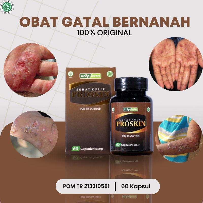 Jual Proskin - Obat Kulit gatal bernanah, Obat Luka Bernanah, Obat ...