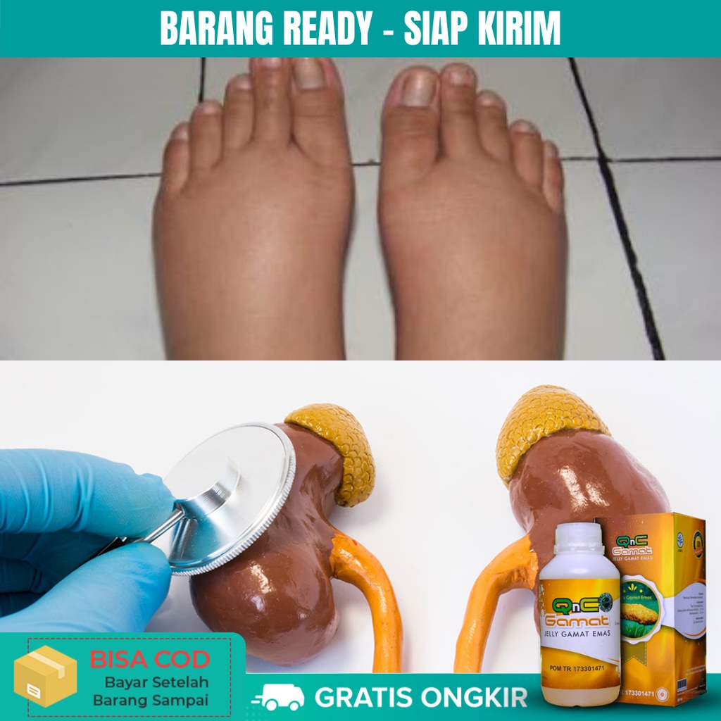 Jual Obat Ginjal Bocor Anak Dewasa BPOM - Obat Bocor Ginjal - Obat ...