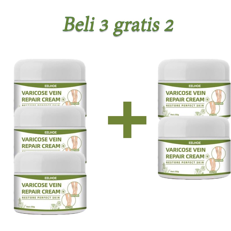 Jual Varicose Veins Treatment Cream Salep Vaskulitis Flebitis Spider ...
