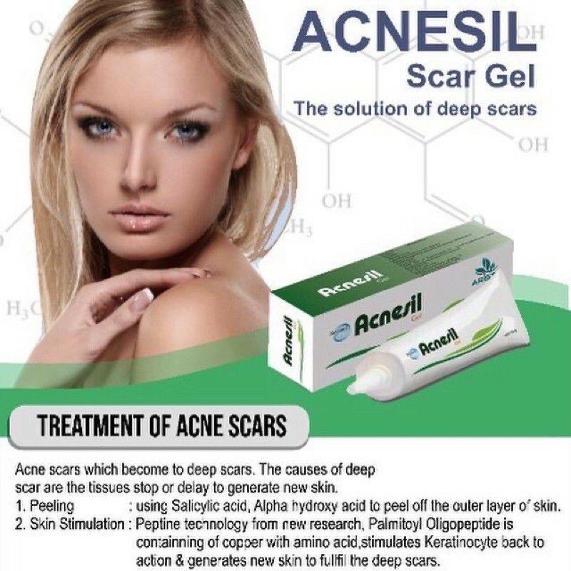 Jual acnesil scar gel - cream bopeng | Shopee Indonesia
