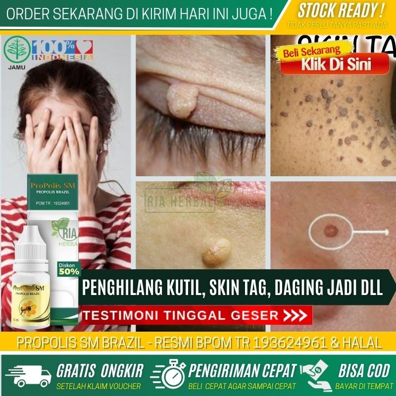Jual SALEP ALAMI KUTIL DI KELOPAK MATA 100% AMAN BPOM, OBAT PENGHILANG ...