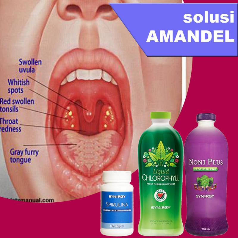 Jual Obat Amandel Herbal Plus Suplemen Daya Tahan Tubuh Anak dan Dewasa | Shopee Indonesia