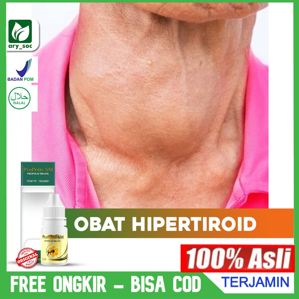 Jual Obat Hipertiroid, Tyroid - Tiroid Bengkak - Gondok - Lipoma ...