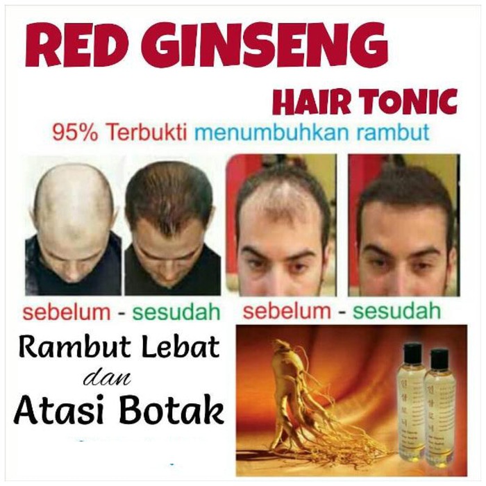 Jual Red Ginseng Hair Tonic Penumbuh rambut alami Bpom 275ml Made In ...