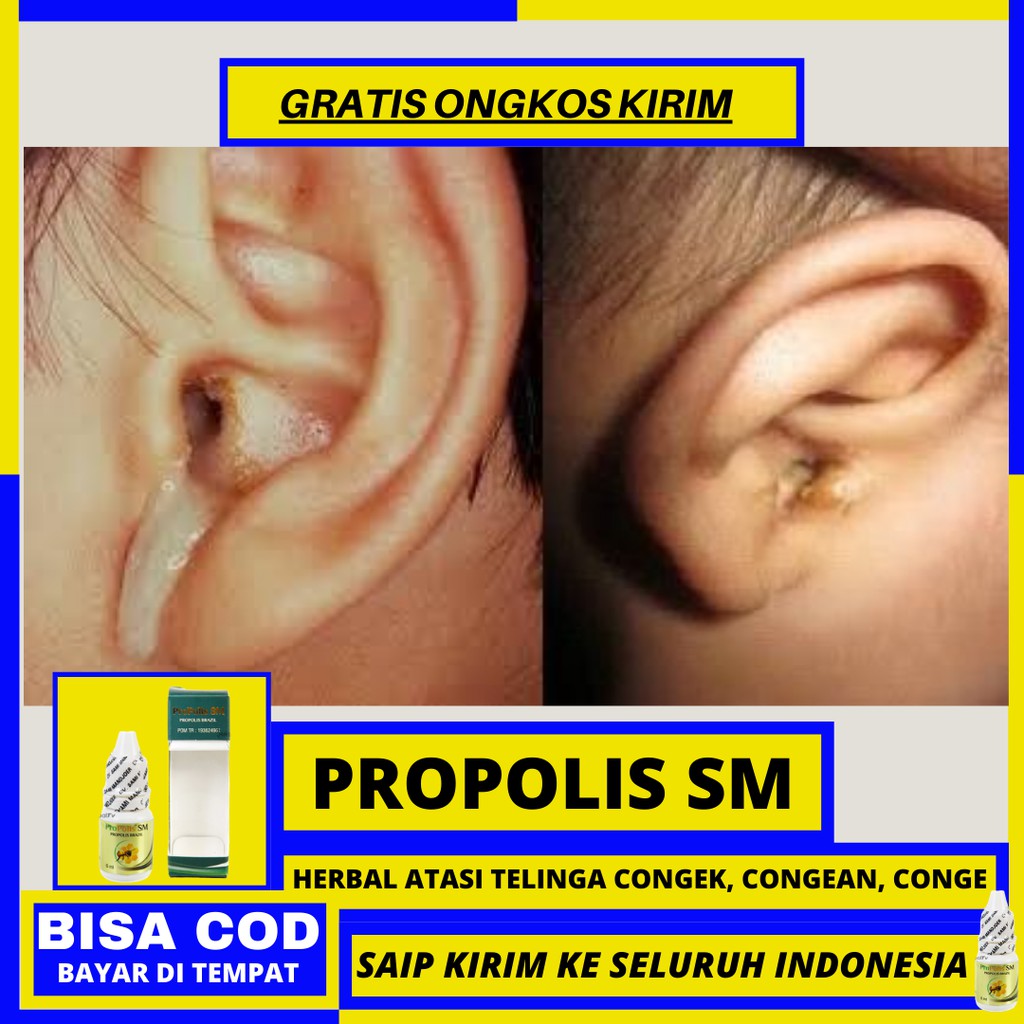 Jual Obat Congek Tersumbat, Obat Congean, Obat Conge | ProPlis SM ...