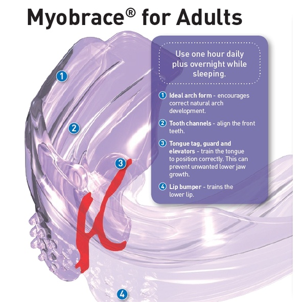 Jual MYOBRACE for ADULT (DEWASA) 15+/ MYOFUCTIONAL ORTHODONTICS ...