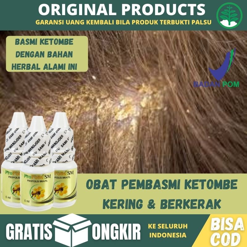 Jual Obat Alami Pembasmi Ketombe Berkerak, Ketombe Basah, Ketombe Kering, Gatal2 Kulit Kepala ...