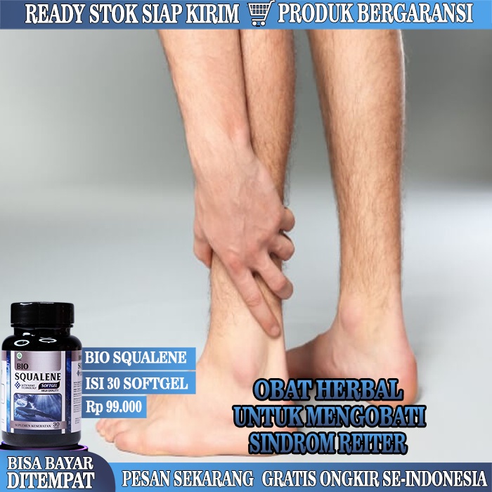 Jual Obat Sindrom Reiter, Obat Pembengkakan & Nyeri Sendi, Obat Sindrom ...