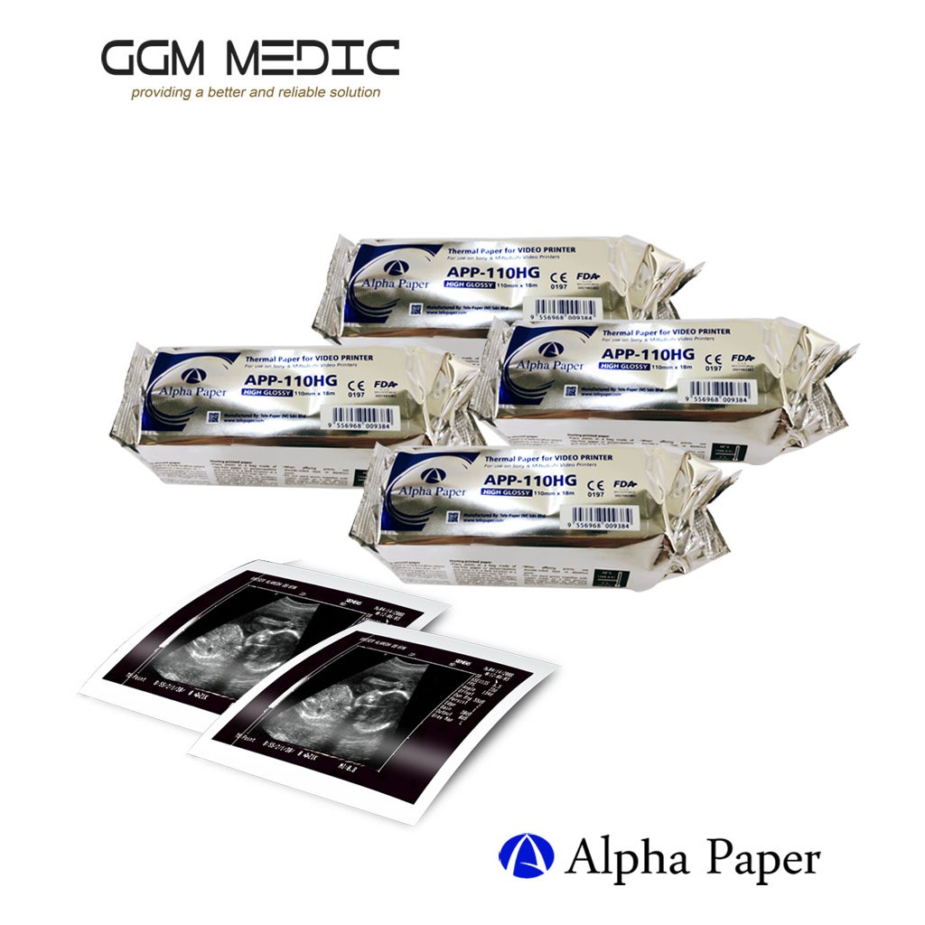 Jual USG Paper / Kertas USG - Video Printer Paper - Alpha Paper | APP ...