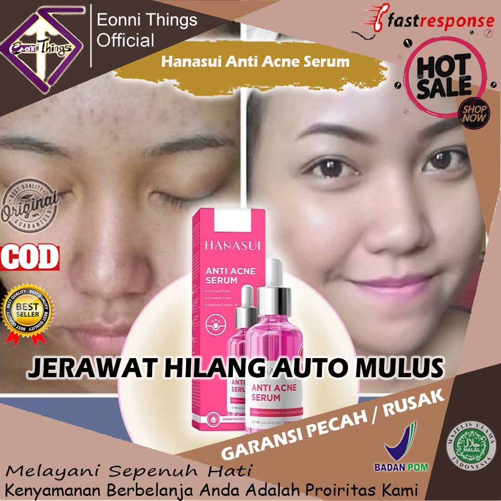 Jual Serum Jerawat Skincare Scincare skin care skinker skincer ...