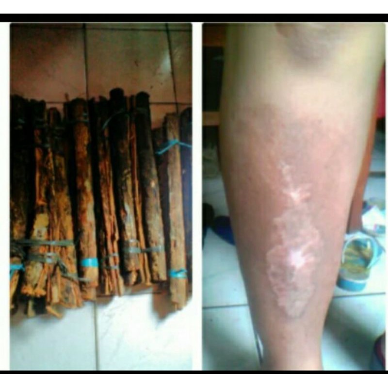 Jual kayu raru obat diabetes 250gram | Shopee Indonesia