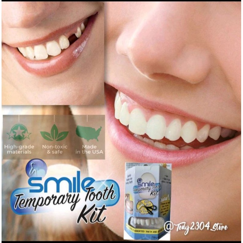 Jual instant smile temporary tooth kit original !!! | Shopee Indonesia