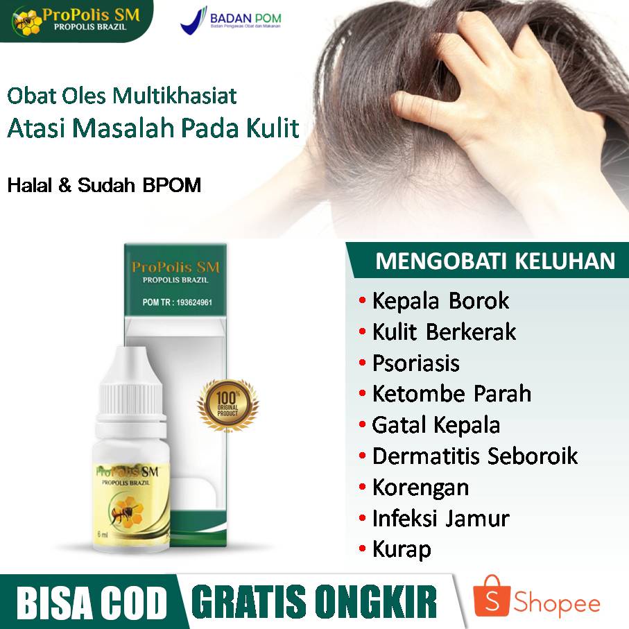 Jual Obat Kepala Borok, Kulit Kepala Berkerak Dan Bersisik, Ketombe Parah, Korengan, Infeksi ...