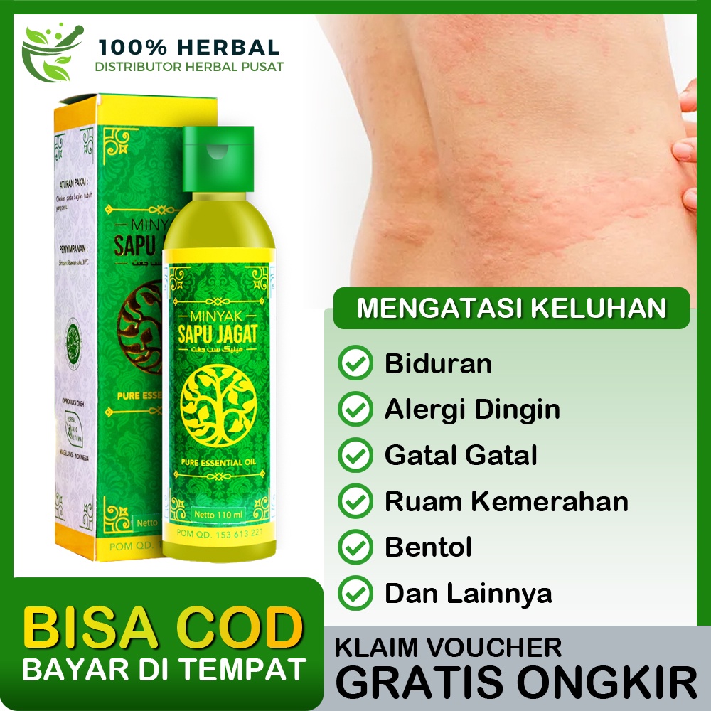 Jual Obat Oles Biduran Alergi Dingin Kaligata Gatal Kulit Bentol Bintik ...