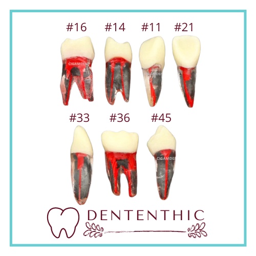 Jual Model gigi endo endodontik / Gigi endodontik dengan saluran akar ...