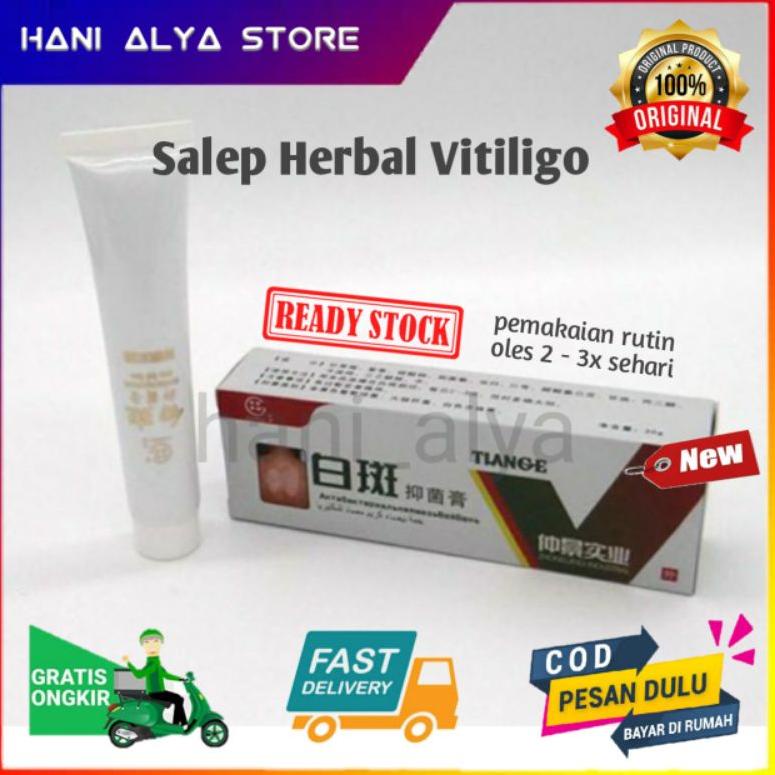 Jual [KODE BARANG J7924] OBAT SALEP VITILIGO BERCAK PUTIH / KULIT ...