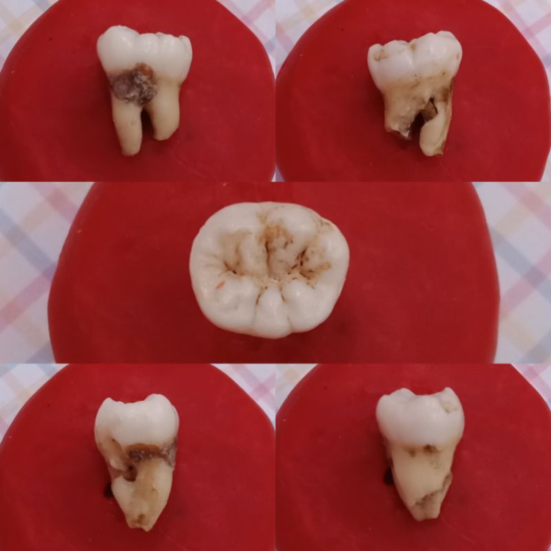 Jual Gigi 48 Gigi Bungsu Gigi Asli Praktikum Gigi Molar Ketiga Rahang ...