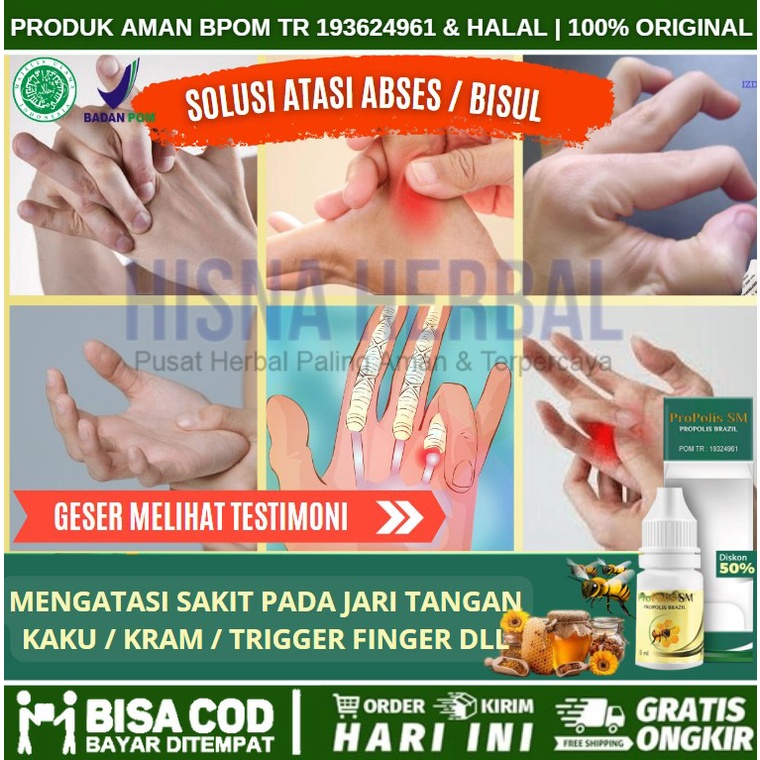 Jual Obat Sakit Di Persendian Jari Tangan, Obat Jari Tangan Sakit dan ...