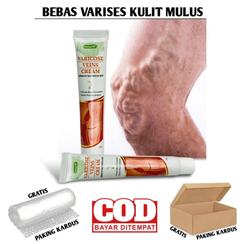 Jual OBAT VARISES OBAT PARISES VARICOSETE | Shopee Indonesia