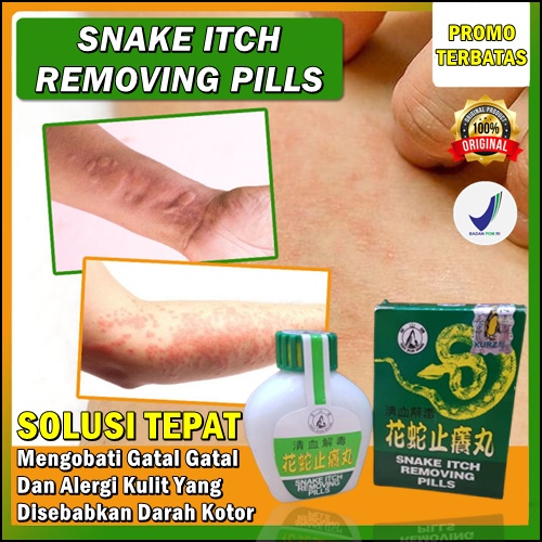 Jual TERLARIS snake itch removing pills obat gatal" original obat ...