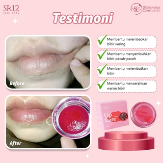Jual SR12 LIP CARE / PELEMBAB BIBIR / LIP BALM / PENCERAH WARNA BIBIR AMAN BPOM | Shopee Indonesia