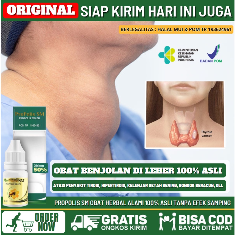 Jual Obat Tiroid Aman Alami, Obat Alami Benjolan di Leher, Obat ...