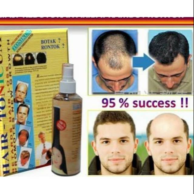 Jual HAIR TONICUM SPRAY/OBA-T Penumbuh Rambut~Atasi Kebotakan Rambut ...