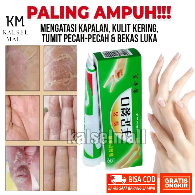 Jual Cream Salep Obat Krim Original 100% AMAN AMPUH Salap Tumit Kaki ...