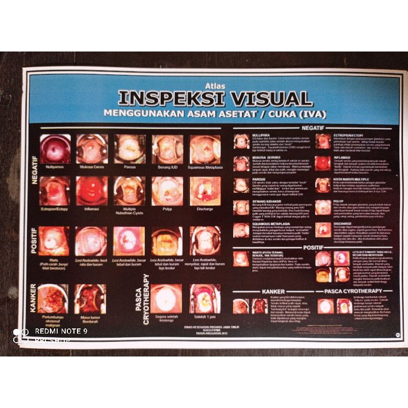 Jual (63) POSTER IVA | Shopee Indonesia