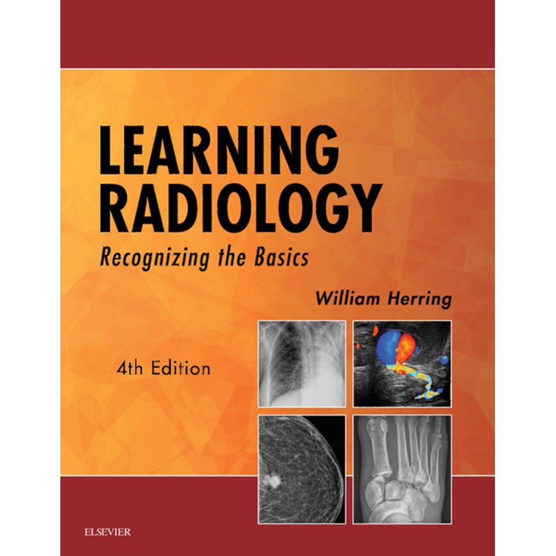 Jual Buku Kedokteran Learning Radiology: Recognizing the Basics By William Herring MD FACR ...