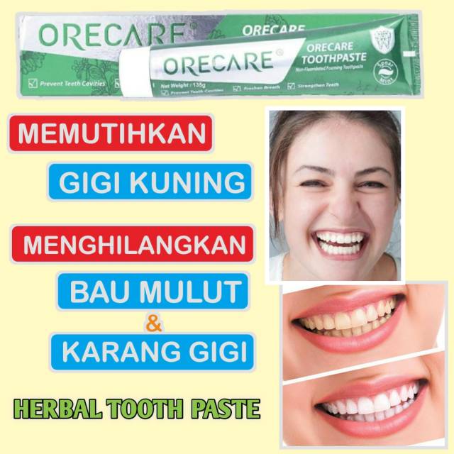 Jual Pasta pemutih gigi (orecare) | Shopee Indonesia Jual Pasta pemutih gigi (orecare) | Shopee Indonesia