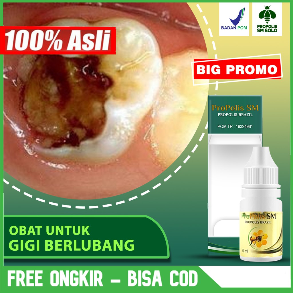 Jual Obat Sakit Gigi Berlubang, Penghancur Gigi Berlubang Dan Gusi ...