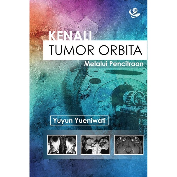 Jual Buku Kedokteran Kenali Tumor Orbita Melalui Pencitraan | Shopee Indonesia