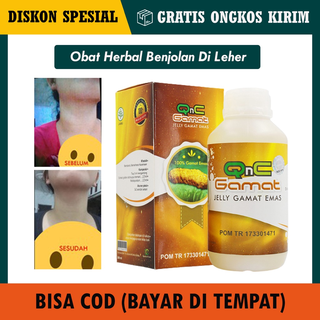 Jual Obat Kelenjar Getah Bening / Kelenjar Tiroid / Benjolan Di Leher ...
