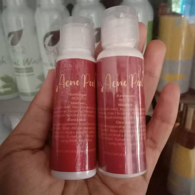 Jual Acne peeling SR12 obat bopeng | Shopee Indonesia
