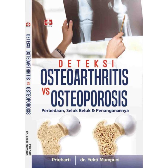 Jual Deteksi Osteoarthritis Vs Osteoporosis, Perbedaan, Seluk Beluk Dan Penanganannya | Shopee ...
