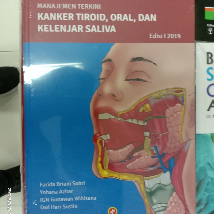 Jual Buku ORIGINAL- Buku MANAJEMEN TERKINI KANKER TIROID ORAL DAN KELENJAR SALIVA Edisi1 2019 ...