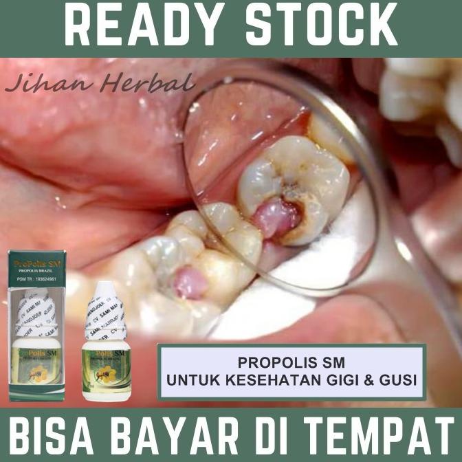 Jual Obat Sakit Gigi Berlubang, Nyeri Gusi, Gusi Bengkak, Gusi Berdarah, Perontok Karang Gigi ...