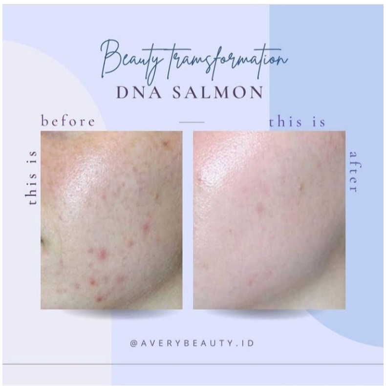 Jual Salmon DNA Injection Clapio Bright Cell | Shopee Indonesia