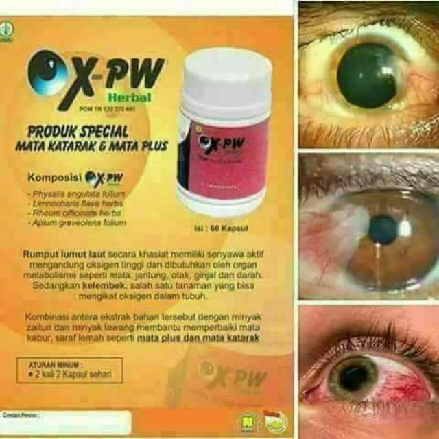 Jual OXPW Mata Katarak dan Mata Plus / Memperbaiki Mata Kabur, Katarak ...