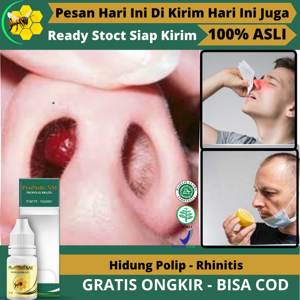 Jual Obat Tetes Polip Hidung, Benjolan Di Dalam Hidung, Sinusitis, Obat ...