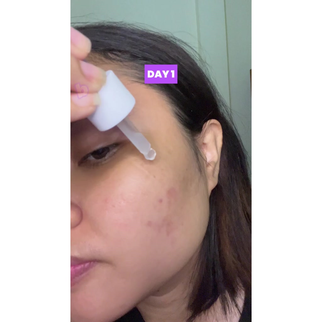 Jual GLOW FX Glow Bomb Serum - Serum Glowing & Bekas Jerawat 19% ...